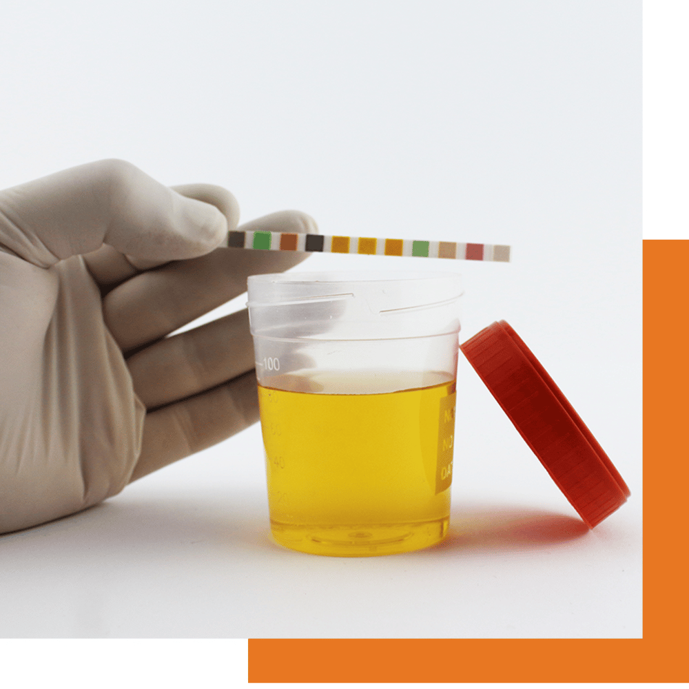 Uritop +11 – Biosynex